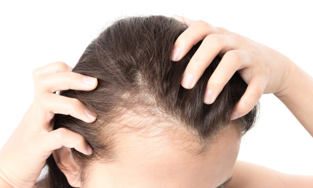 Hair Loss Treatment Tips | Ergonomics Simplified